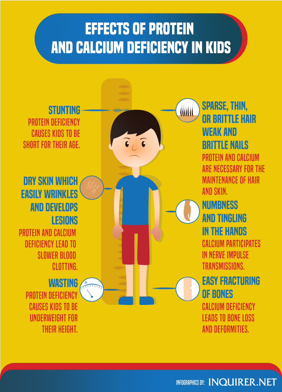 Here’s How Protein and Calcium Deficiency Can Affect Your Kid’s Health ...